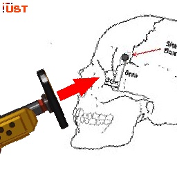 Lobotomy Hammer | Thunderstore - The ULTRAKILL Mod Database